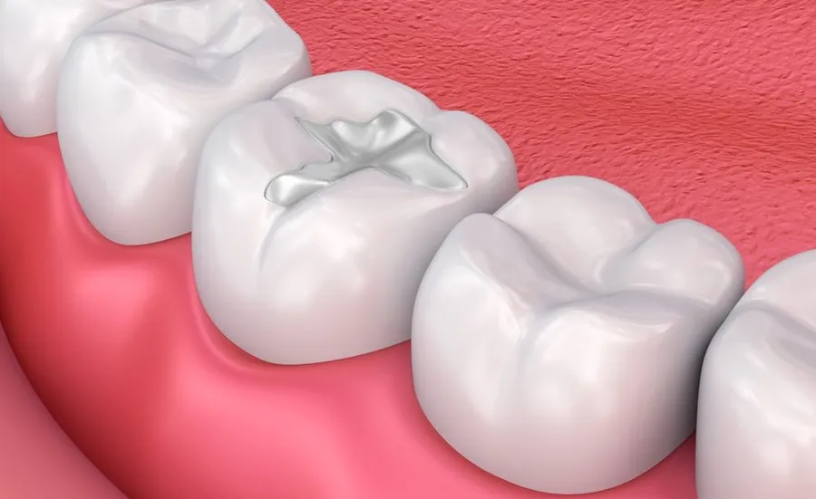 Dr Mishqah Dollie - Leading Dentist in Ottery, Cape Town | Professional ...